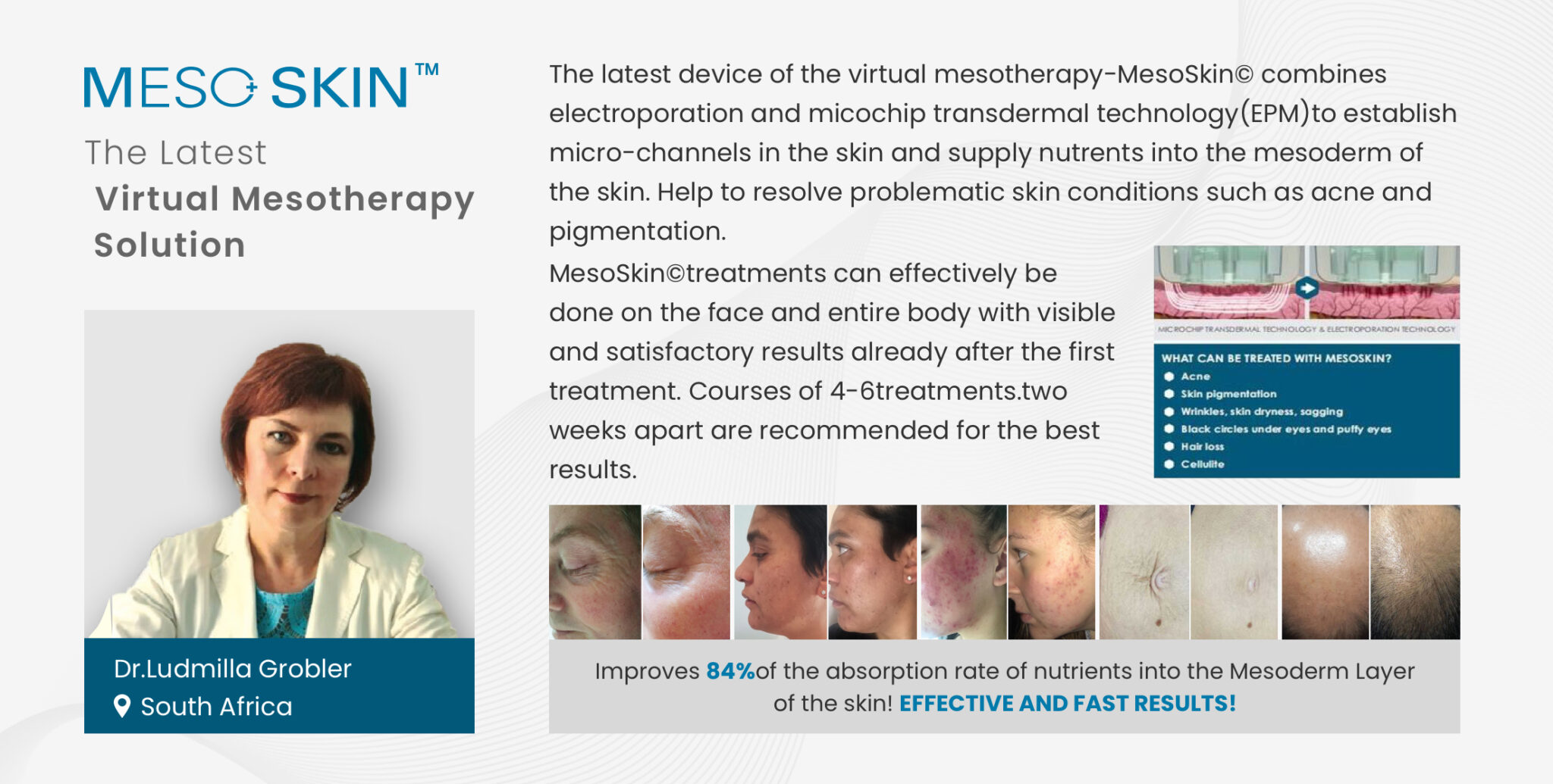 Dr. Ludmilla Grobler's study about Mesoskin - Wingderm Electro-Optics Ltd.